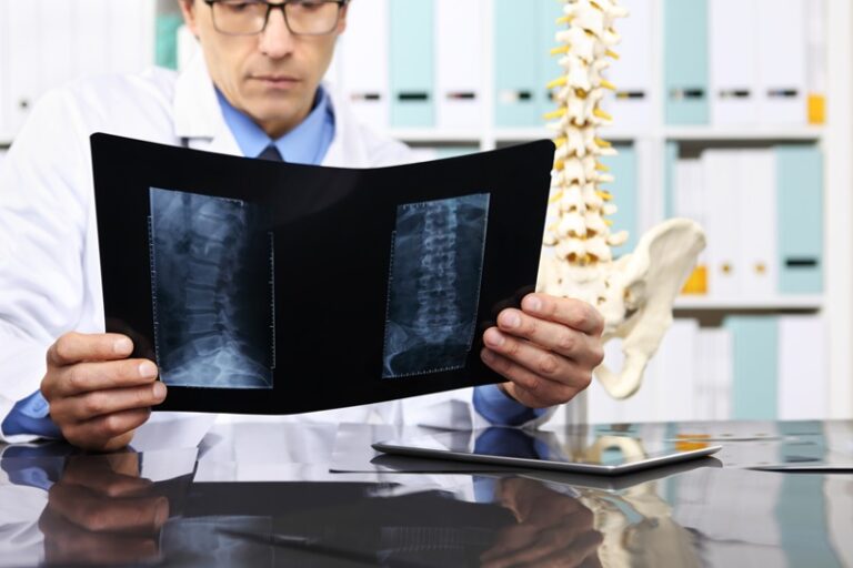 What You Need to Know about Sacroiliac (SI) Joint Fusion – Lonseth ...
